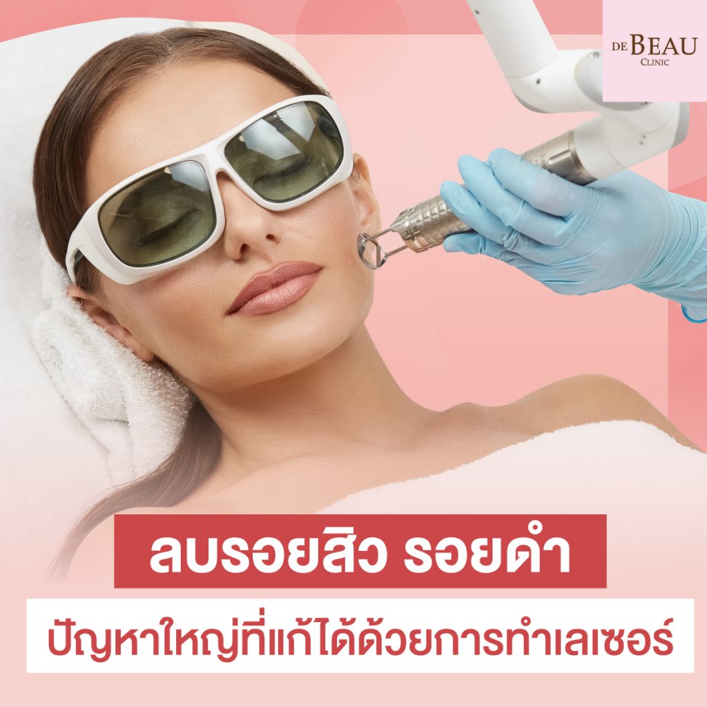 บทความ - DE BEAU CLINIC