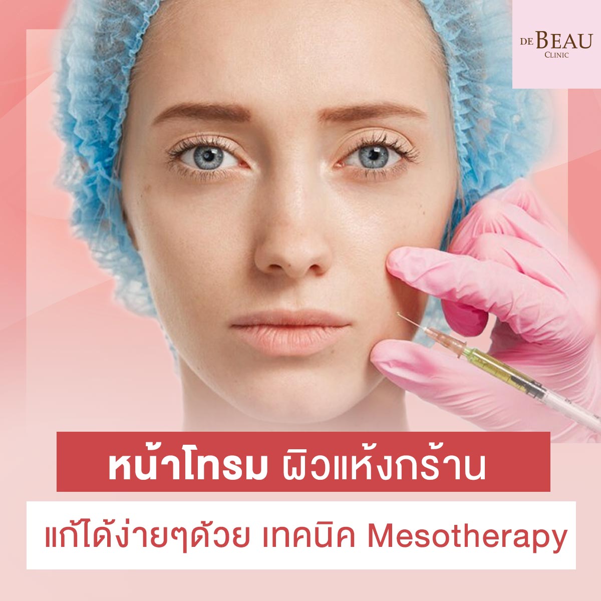 หน้าโทรม ผิวแห้งกร้าน แก้ได้ง่าย ๆ ด้วยเทคนิค Mesotherapy